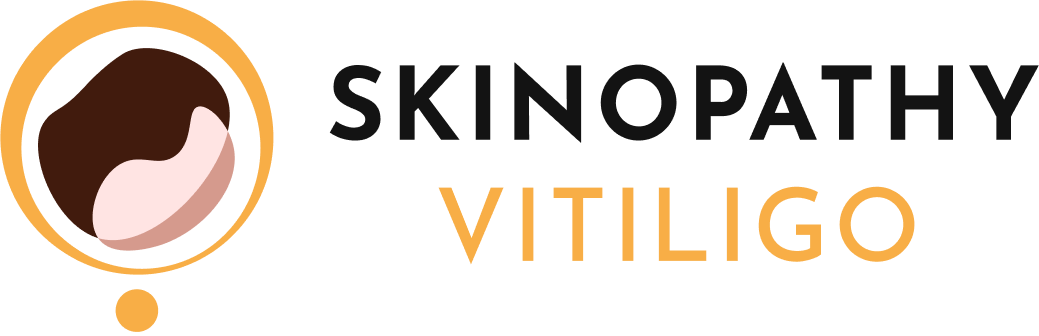 Vitiligo - skinopathy.com